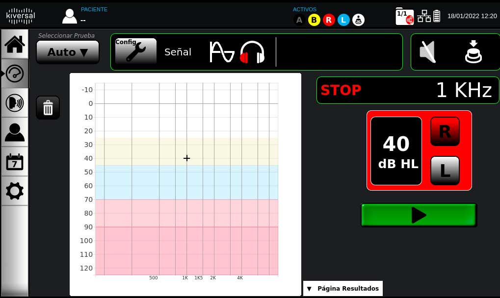 Cómo interpretar una audiometría: las claves » Miaudífono